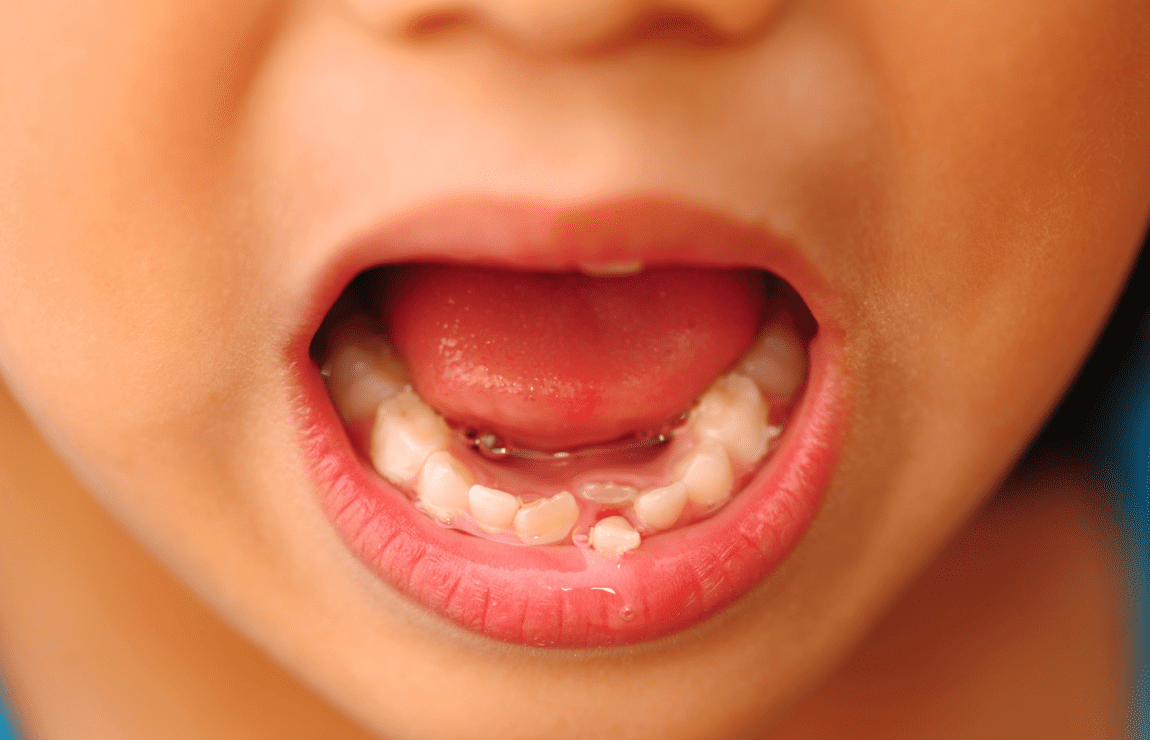 How To Pull A Tooth Without Pain: Tooth Pulling 101 (2026) - Milwaukee ...