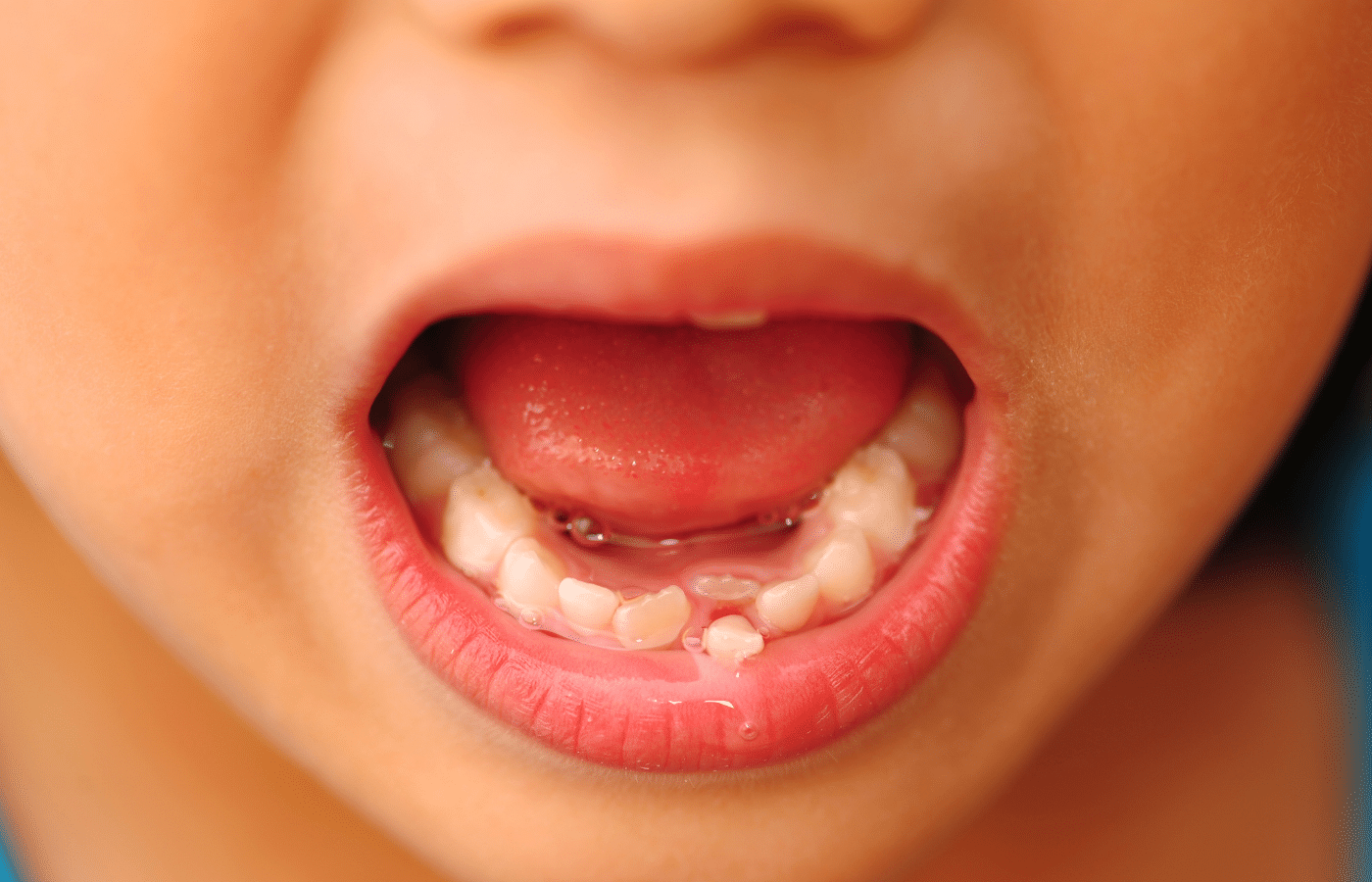 How To Pull A Tooth Without Pain: Tooth Pulling 101 (2026) - Milwaukee ...