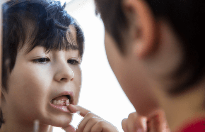 How To Pull A Tooth Without Pain: Tooth Pulling 101 (2026) - Milwaukee ...